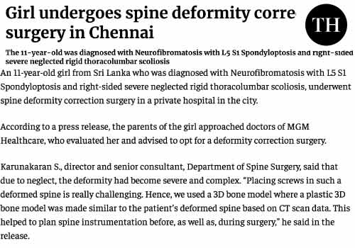 Girl undergoes spine deformity correction surgery in Chennai - MGM Healthcare | Best Super ...